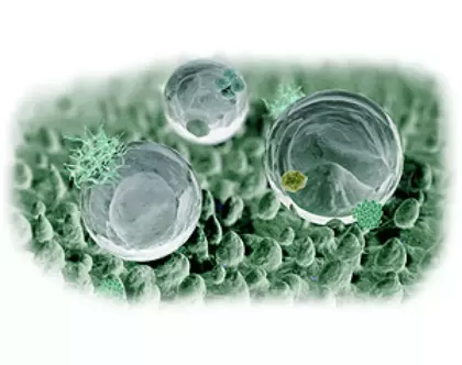 Zakaj pride do nastanka alg in plesni na fasadi? | Saint-Gobain Slovenija